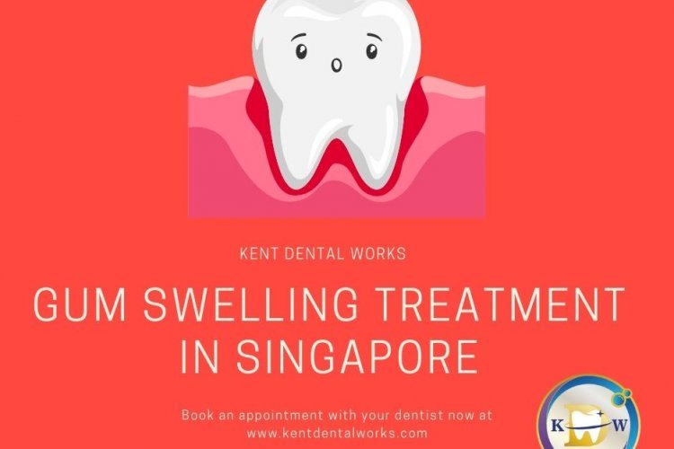 Treatment for Gum Swelling in Singapore - Kent Dental Works - Africa ...